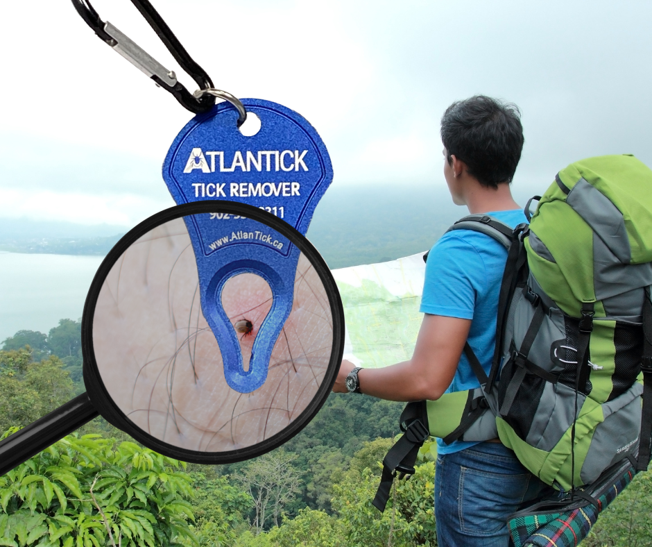 Mastering Tick Removal: An Easy, Effective Step-by-Step Guide ...